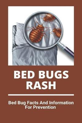 Bed Bugs Rash: Bed Bug Facts And Information For Prevention ...