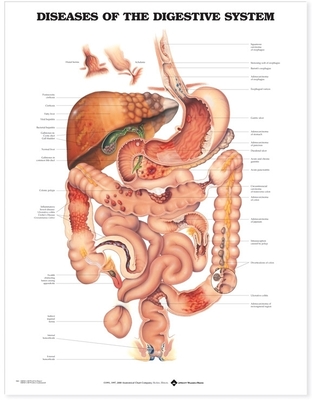 Diseases of the Digestive System Anatomical Chart - Anatomical Chart ...